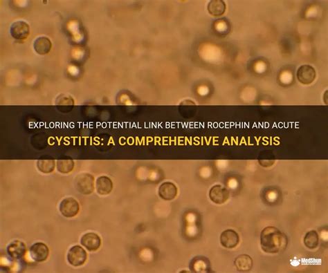 Exploring The Potential Link Between Rocephin And Acute Cystitis A