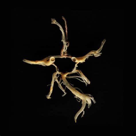 20 Circle Of Willis Fotografías De Stock Fotos E Imágenes Libres De Derechos Istock