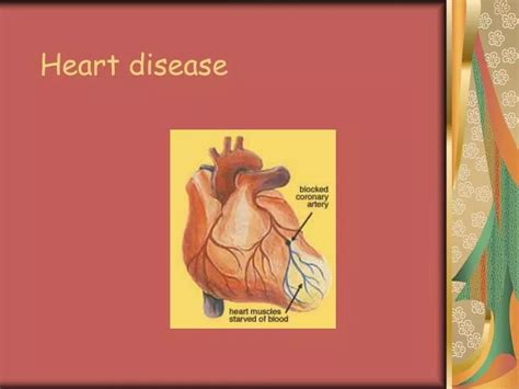 Ppt Heart Disease Powerpoint Presentation Free Download Id6748233