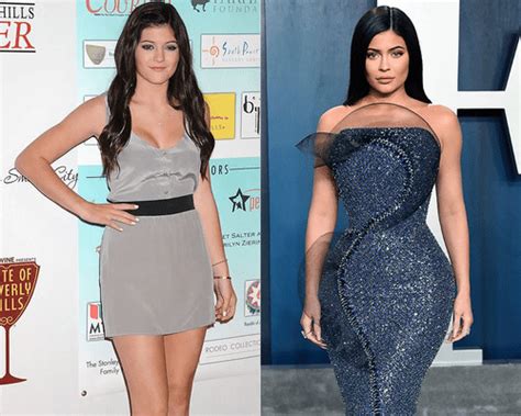 Kardashians Before And After Plastic Surgery Full Guide Fabbon