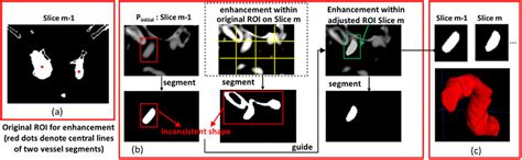 Illustration Of Roi Adjustment Based On Shape Continutity And