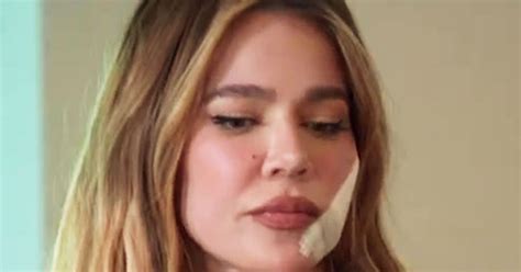 Khloe Kardashian Shows Off Huge Facial Scar As She Reveals Cancer Scare Irish Mirror Online