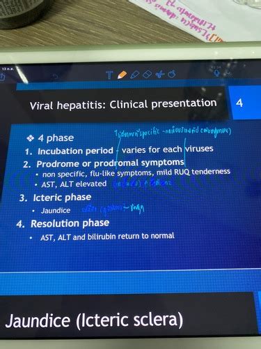 Hepatitis Flashcards Quizlet