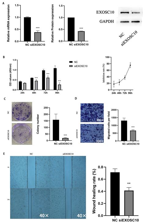 Exosc10 Is A Novel Hepatocellular Carcinoma Prognostic Biomarker A Comprehensive Bioinformatics