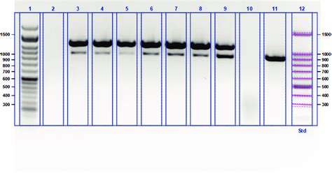 Gradient Pcr Amplification Of The 16s18s Rrna Genes From Haematococcus Download Scientific