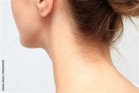 Why Is It Called Nape Of The Neck At Sara Miller Blog