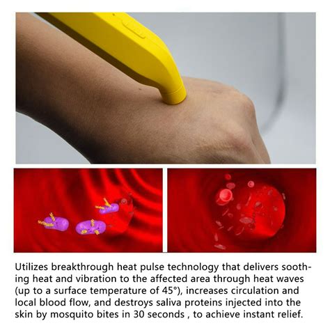 Palo Antipicazón Para Picaduras De Insectos Bolígrafo Electrónico