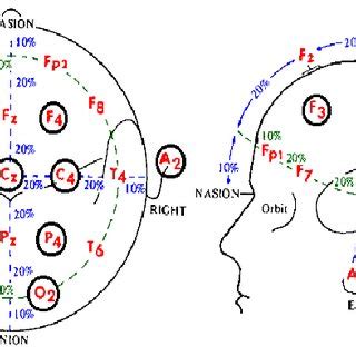 The International 10 20 System Download Scientific Diagram