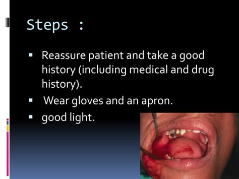 Management Of Post Operative Bleeding Part Pptx