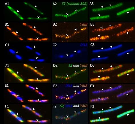Subcellular Localization Of Ydib Ribosomes And Nucleoids In B Download Scientific Diagram