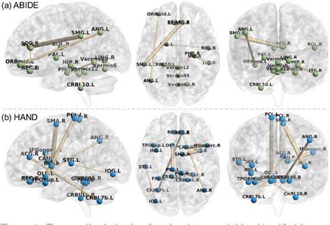 Figure 1 From Leveraging Brain Modularity Prior For Interpretable