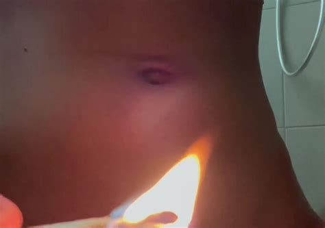 Belly Button Burning Part 3