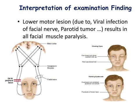 Cranial Nerve Examinationpptx