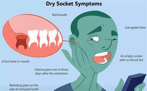 A Dry Socket What Is It Why Does It Happen And How Is It Treated Dentist Isle Of Man