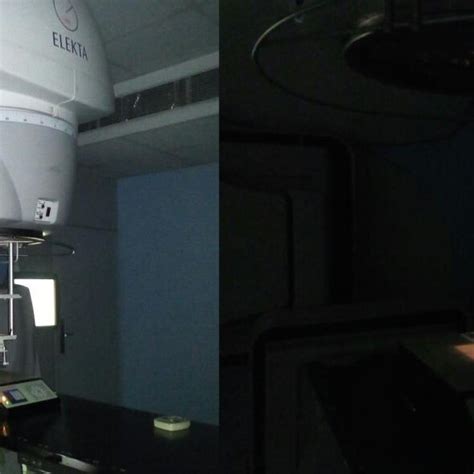 The Qcw Setup For Daily Measurements On The Elekta Synergy Linear