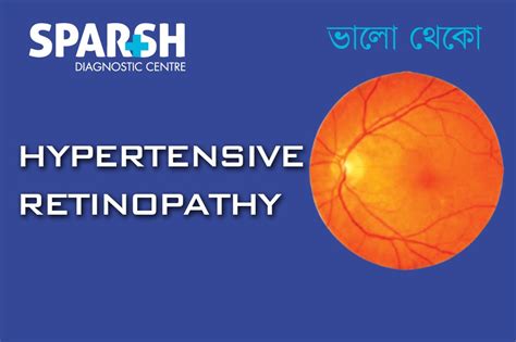 Hypertensive Retinopathy Sparsh Diagnostic Center