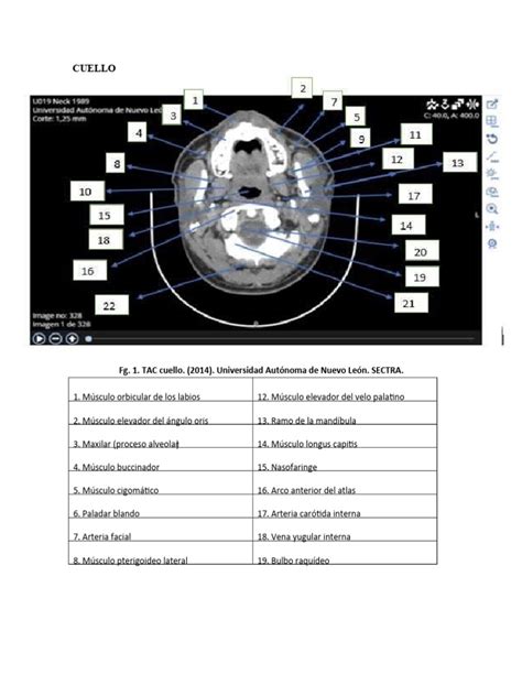 Anatomia Multiplanar Kevin Olmedo Vanegas Unidad 2 Tarea 4 Pdf