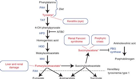 Tyrosinemia Pathway