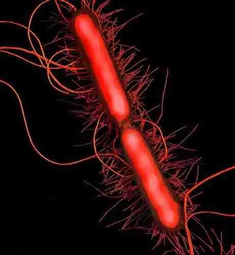 Proteus Vulgaris An Overview Identification Infections And Treatment Sciborg
