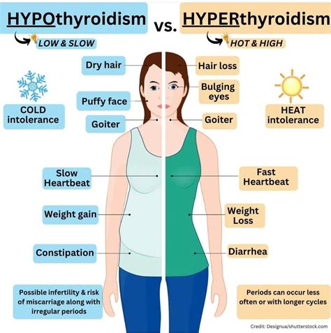 Dhiaa Malih On Linkedin Hyop Vs Hyper In Simple And Easy Way 👌