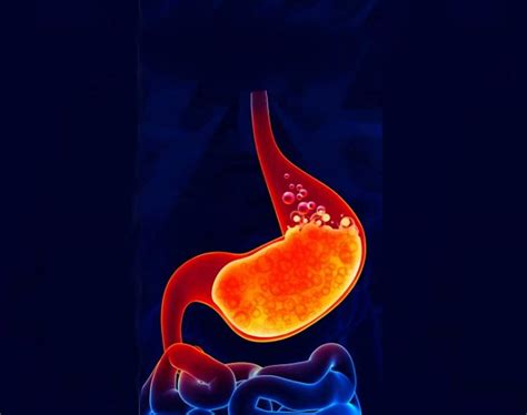 Acidity అసిడిటీ వున్నవారు ఏం తినకూడదు What Should People With Acidity Not Eat Webdunia Telugu