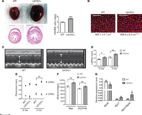 Figure 1 From Mek Erk Pathway Modulation Ameliorates Disease Phenotypes In A Mouse Model Of