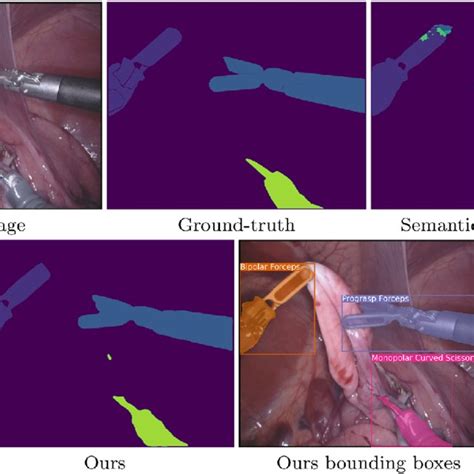Example Of The Instance Segmentation Pipeline Colour Map Part