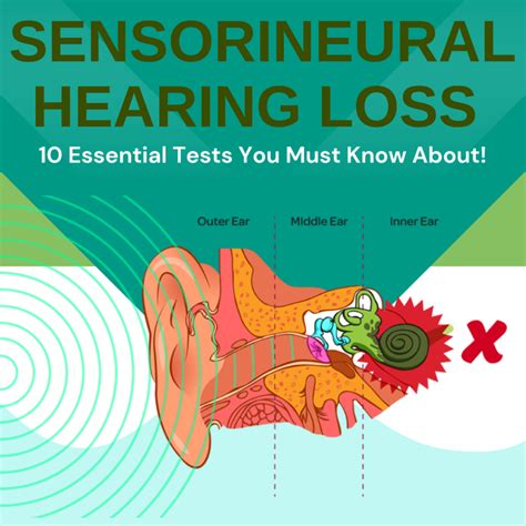 Sensorineural Hearing Loss Diagnosis 10 Essential Tests You Must Know About Sphere Speech