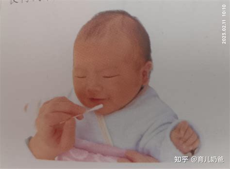 不要擦新生儿的“马牙” 知乎