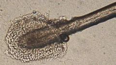 Eyebrow Under Microscope