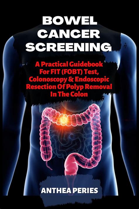 Bowel Cancer Screening A Practical Guidebook For Fit Fobt Test Colonoscopy And Endoscopic