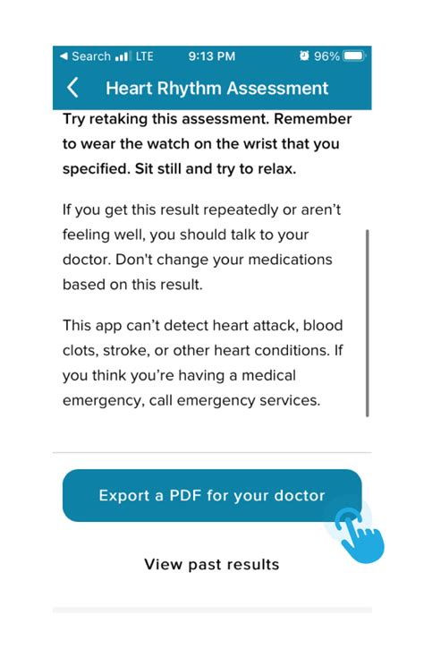 How To Export Your Ecg From Fitbit Qaly