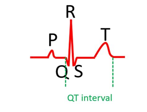 What Are The Normal Values For ECG Measurements All About Heart And Blood Vessels