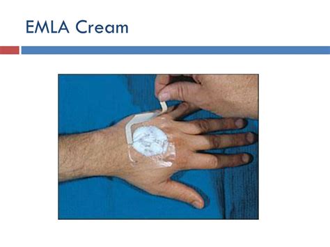 Ppt Infiltration And Topical Anesthesia Powerpoint Presentation Free
