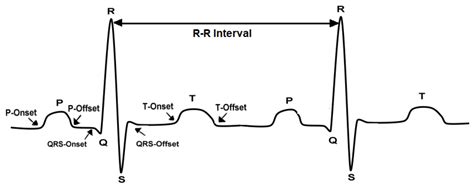 Diagnostics Free Full Text Advanced Time Frequency Methods For Ecg Waves Recognition