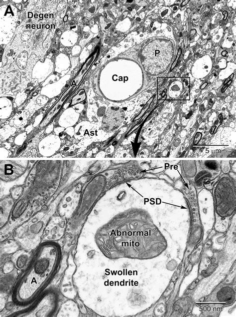 Neuron Microscope Axon