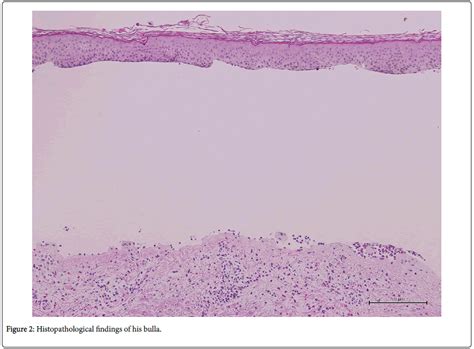 Clinical Experimental Dermatology Research Histopathological Findings