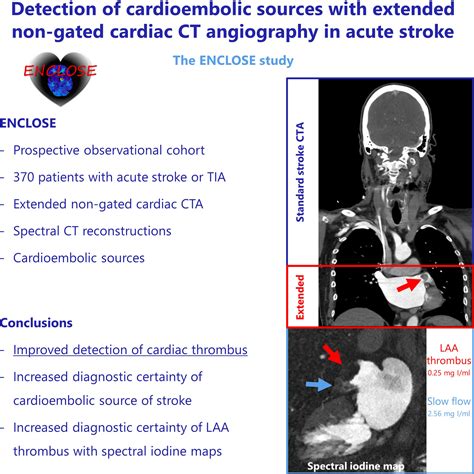 Ct Angiography Heart
