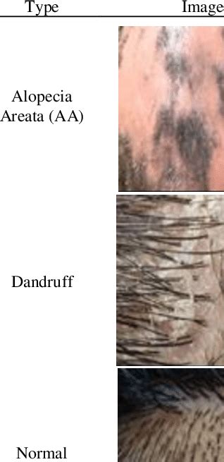 Sample Images Of Scalp Conditions Download Scientific Diagram
