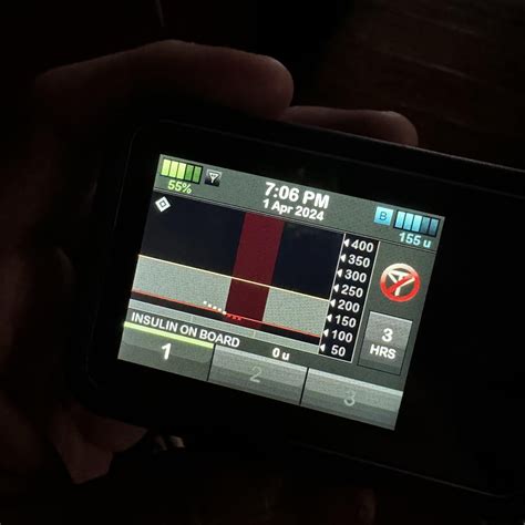 Is This A Dexcom Issue Or A Tandem Issue Rdexcom