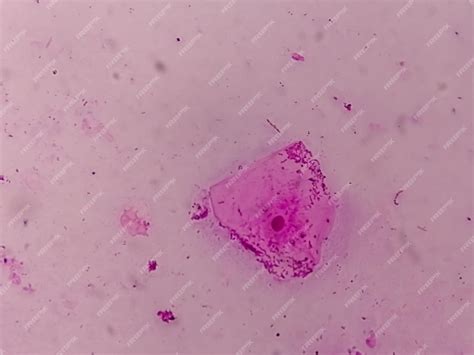 Premium Photo High Vaginal Swab Gram Stain Showing Positive Diplococci And Gram Negative Rods