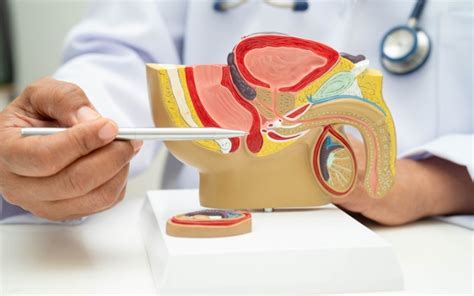Nv Combinación De Fármacos Muestra Beneficios En Un Cáncer De Próstata