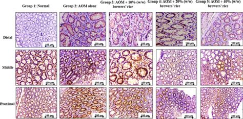 Immunohistochemical Staining Of C Myc The Expression Of C Myc In Three Download Scientific