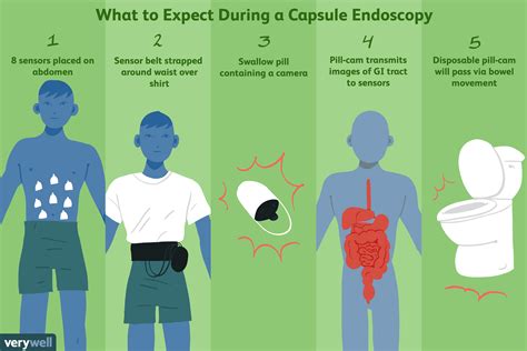 Capsule Endoscopy Uses Side Effects And Results