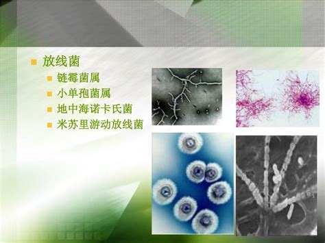 Ppt 第一章 发酵菌种的选育 Powerpoint Presentation Free Download Id4462077