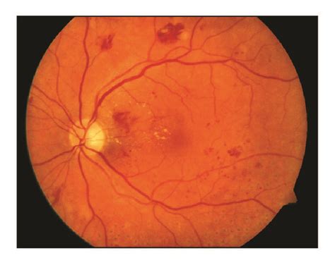 From Left To Right Original Rgb Color Retinal Images A And C