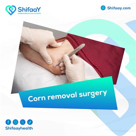 Callus Removal Surgery Corn Removal Surgery Shifaay