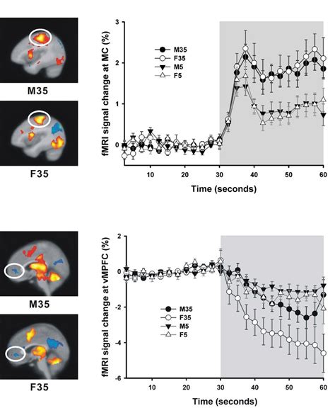 Time Course Of The Bold Response In The Left Primary Motor Cortex Mc