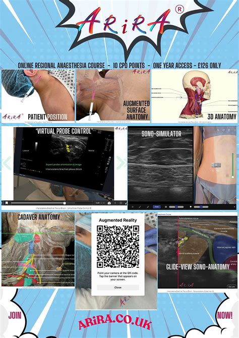 Axillary Brachial Plexus Block