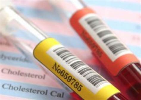 What Is HDL Cholesterol What Is Cholesterol HEART UK